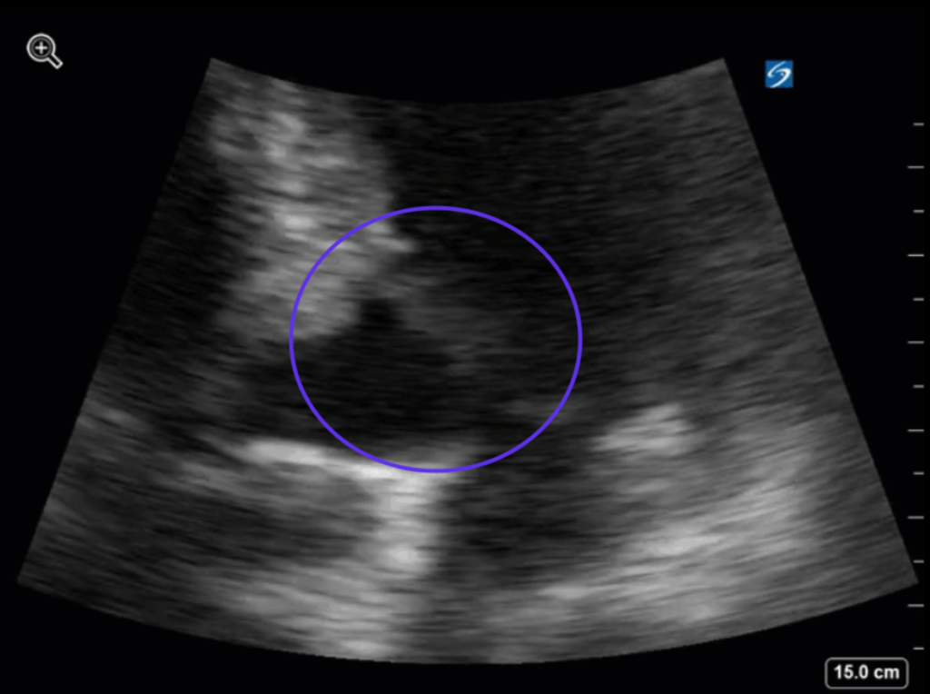 Case of the Week: December 18, 2019 – Western Sono