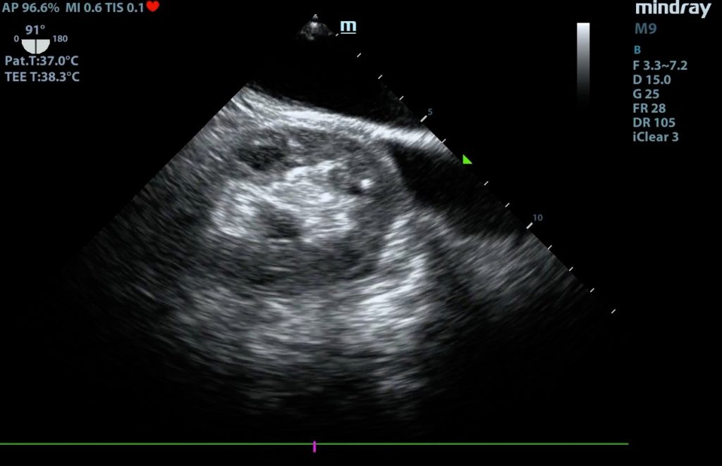Western Sono – Point-of-care Ultrasound Education at Western University