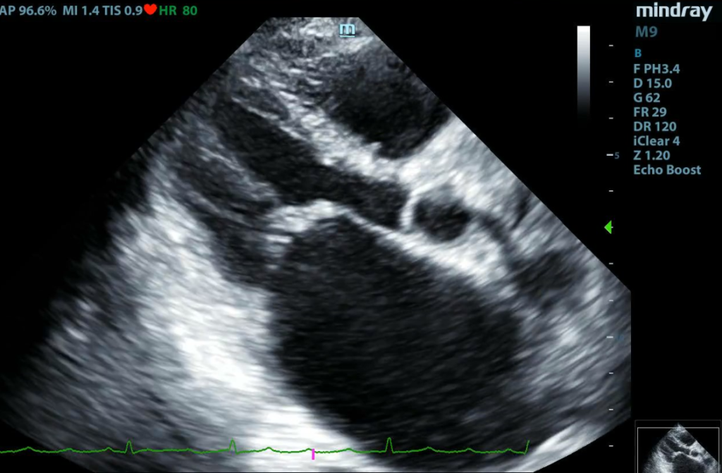 Western Sono – Point-of-care Ultrasound Education at Western University