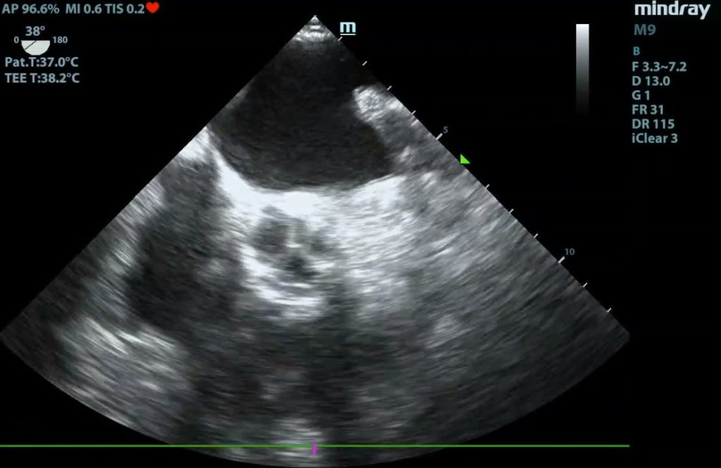 Western Sono – Point-of-care Ultrasound Education at Western University