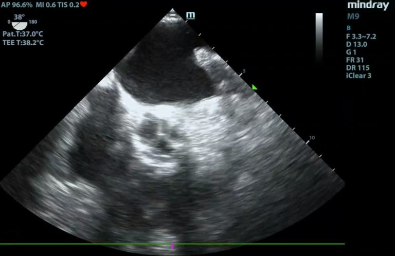 Western Sono – Point-of-care Ultrasound Education at Western University